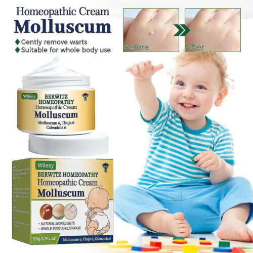 Molluscum Thuja Warts Homeopathy Cream Molluscum Contagiosum In ...