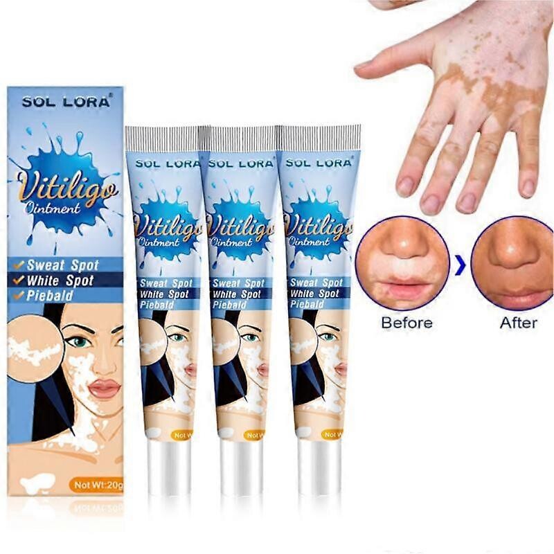 3x Vitiligo Skin Repair Cream,Vitiligo Treatment Cream, Dispose of ...