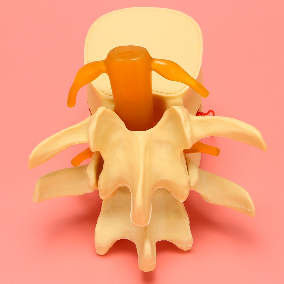 Lumbar Vertebrae Model Lumbar Disc Herniation Anatomy Teaching Tool on ...