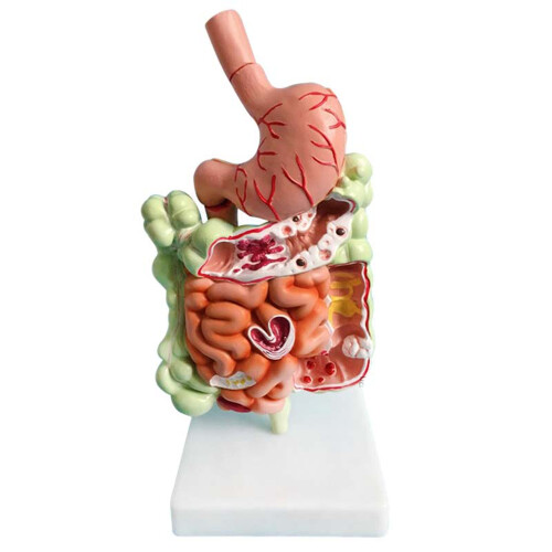 Modelo do Sistema Digestivo Humano Anatomia do Estômago Intestino ...