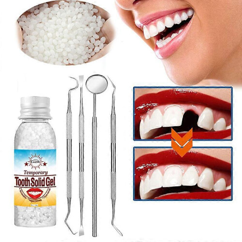 (1 Set) Tooth Repair Kit, Moldable Tooth Filling Repair Kit, Dental ...