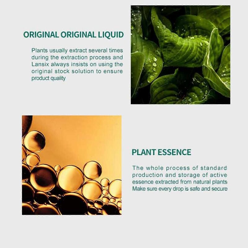 50ml Ouhoe Hair Growing Spray Ginger King Anti-removal Spray Hair ...