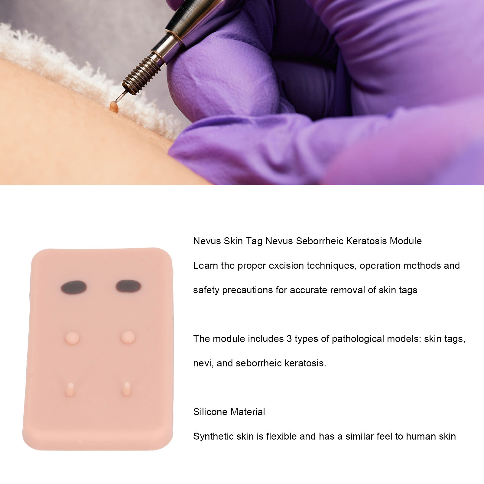 Nevus Skin Tag Nevus Seborrheic Keratosis Module Common Epidermal Disease Silicone Training ...