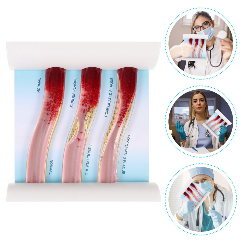 Dynamic Blood Vessel Model Thrombosis for Teaching Explanation on OnBuy