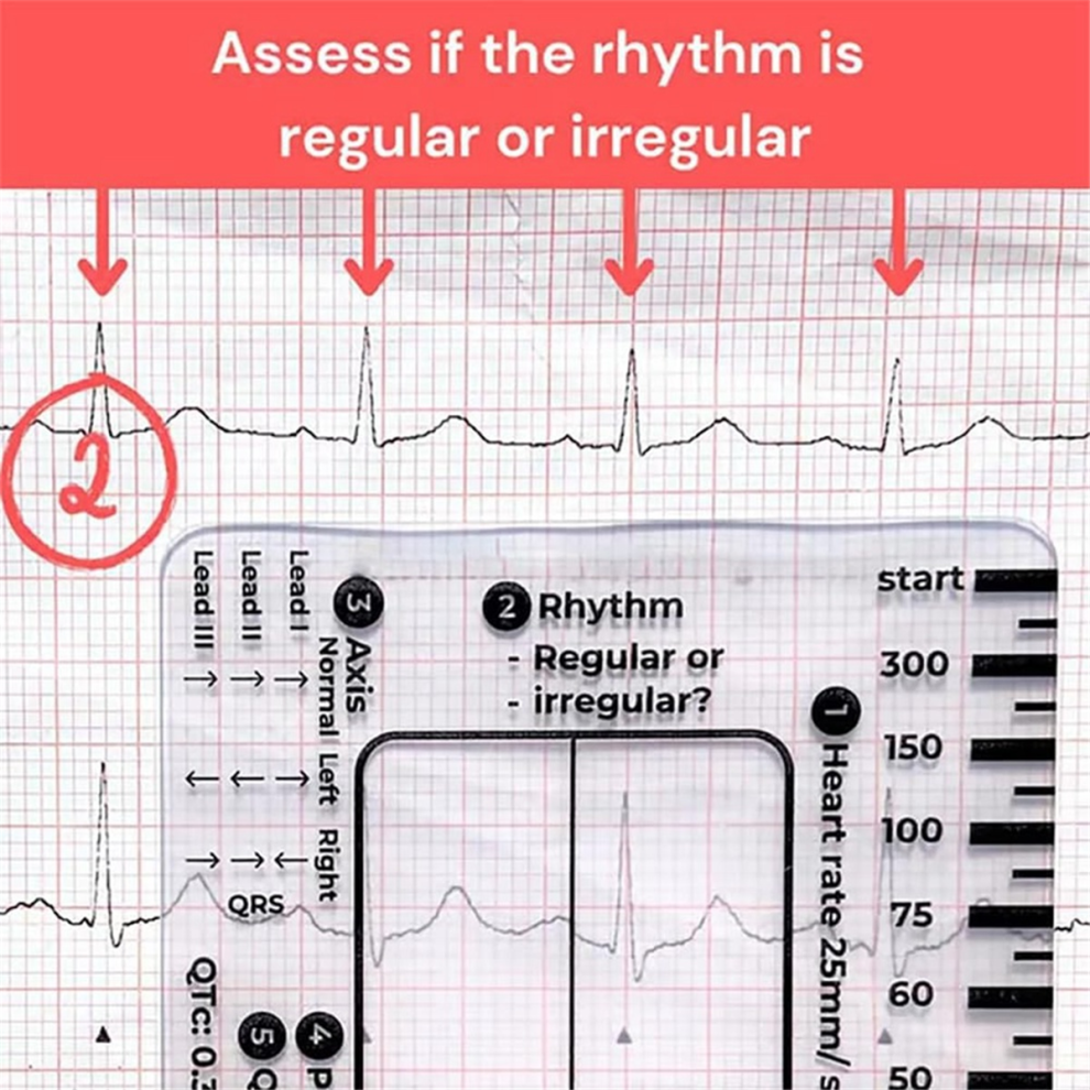 Règle ECG à 7 niveaux, outil de mesure en plastique, pour l ...