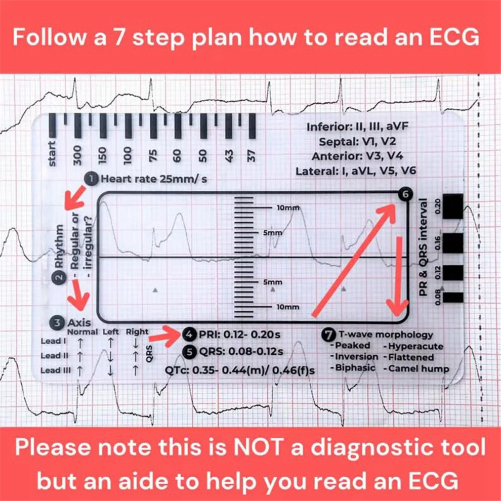 EKG-Lineal mit 7 Schritten zur EKG-Interpretation, EKG-Referenzhandbuch-Lineal on OnBuy
