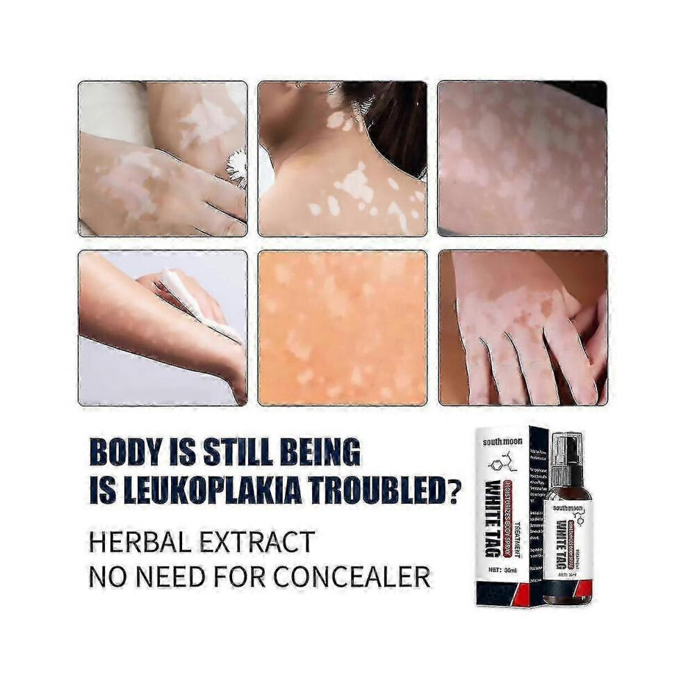 Vitiligo Spray, Vitiligo Treatment for Skin Vitiligo, Vitiligo Care ...