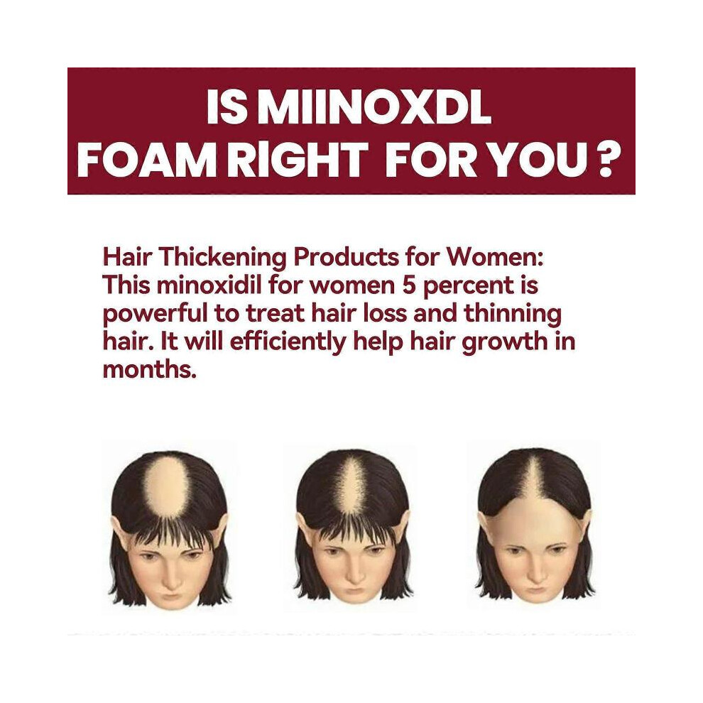 Female Hair Care Foam Deep Repair Root Hair Follicle Dense And Solid ...