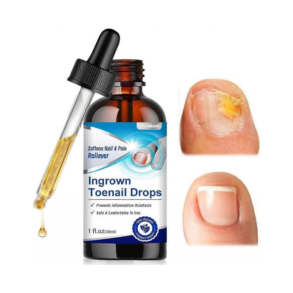Ingrown Toenail Drops, Ingrown Toenail Treatment, Cuticle Care Oil for ...