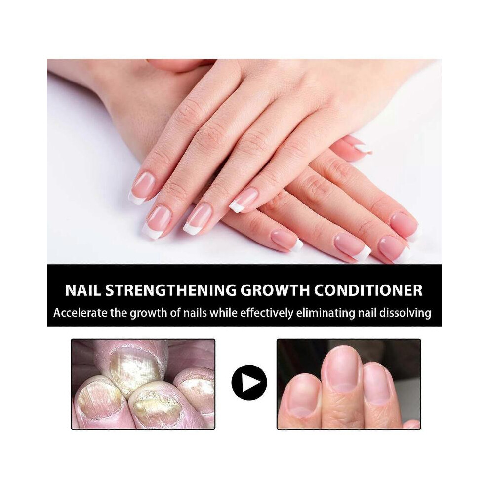 1PCS Onycholysis Heal Nail Strengthening and Growth Conditioner ...