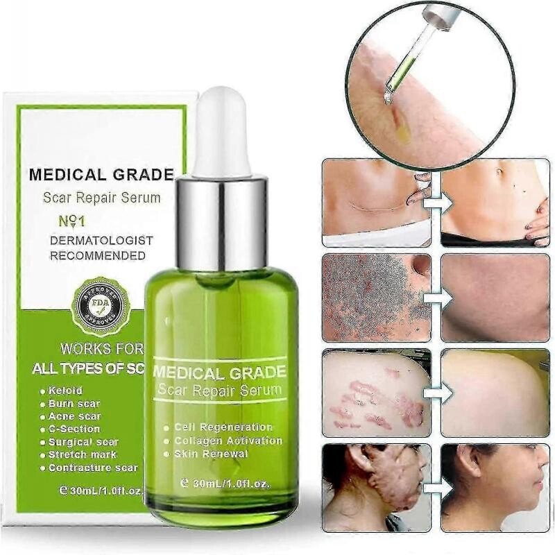 Advanced Scar Repair Serum, Medical Scar Removal Spray, Scar Removal ...
