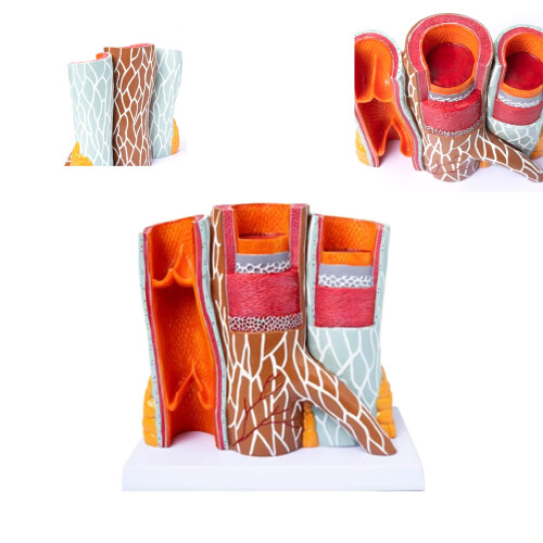 Vascular Model 14-Fold Increase Arterial Vein Structure Educational ...