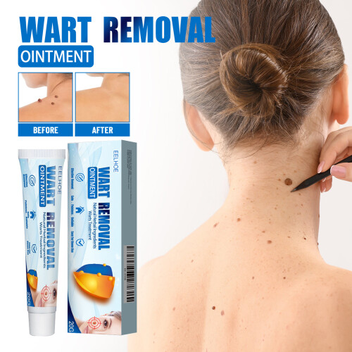 EELHOE Wart Remover Cream 20g Fast Acting Gel Wart ACare Ointment for ...