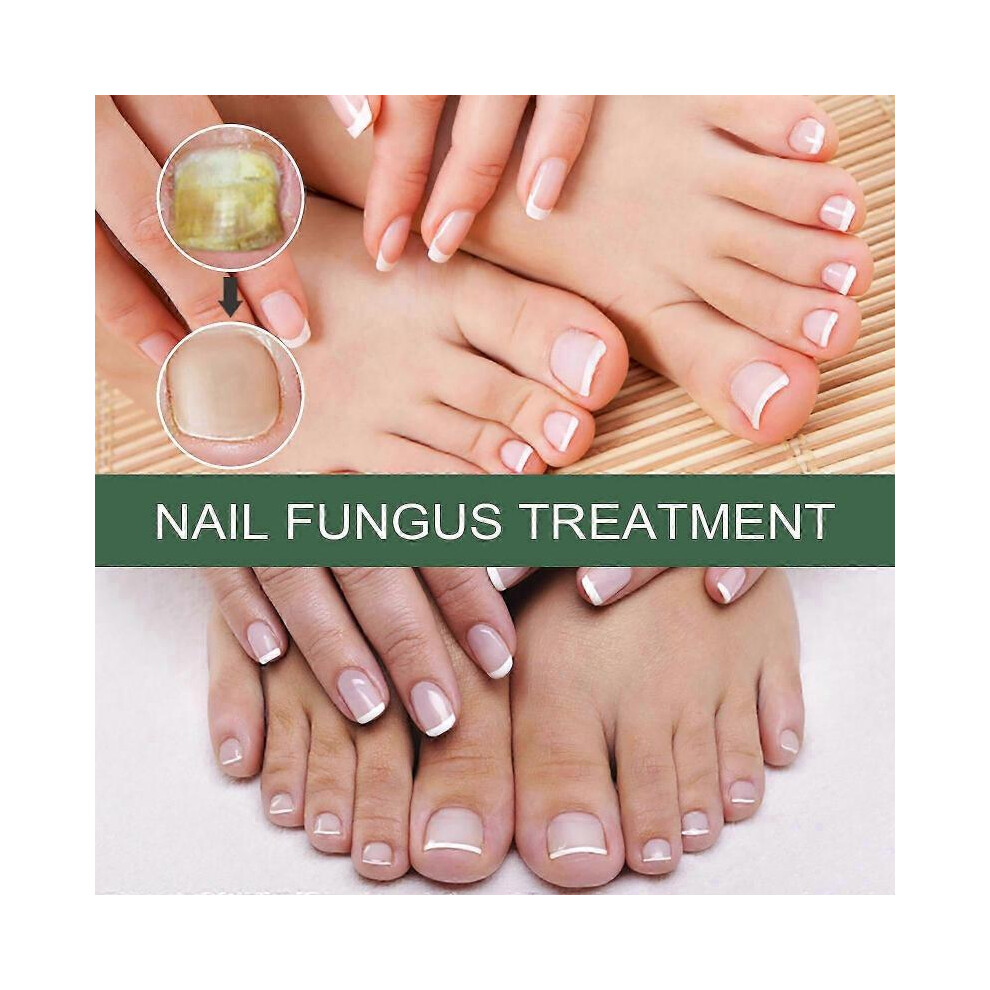 2025 2set Extra Strong Finger & Toenail Fungus Treatment - Best Nail Repair Set, Fungi ...