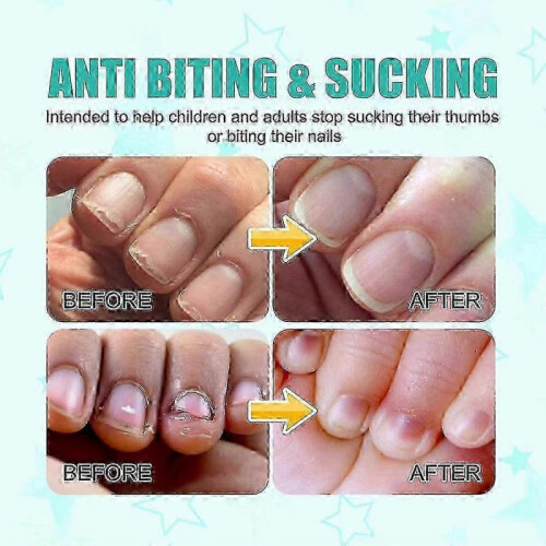 Treating Kids' and Adults' Toenails - Stopping Nail-biting Habits for ...