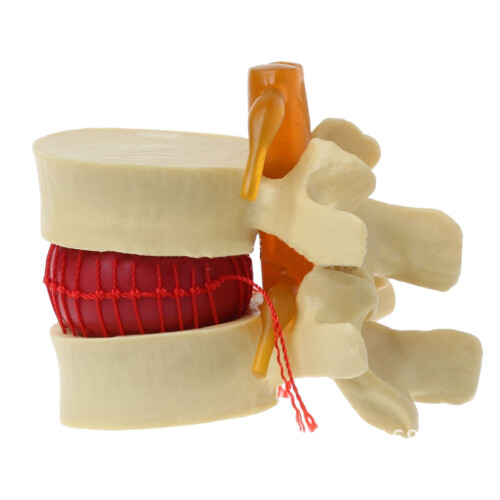 (yellow) Flexible Anatomy Teaching Lumbar Vertebrae Model Understanding ...