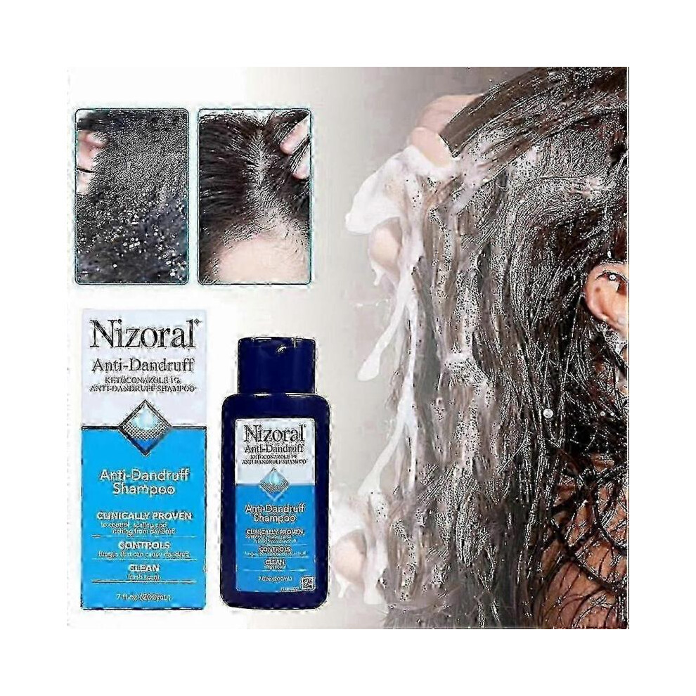 nizoral 7 fl oz 200ml anti dandruff shampoo 2025-T2 on OnBuy