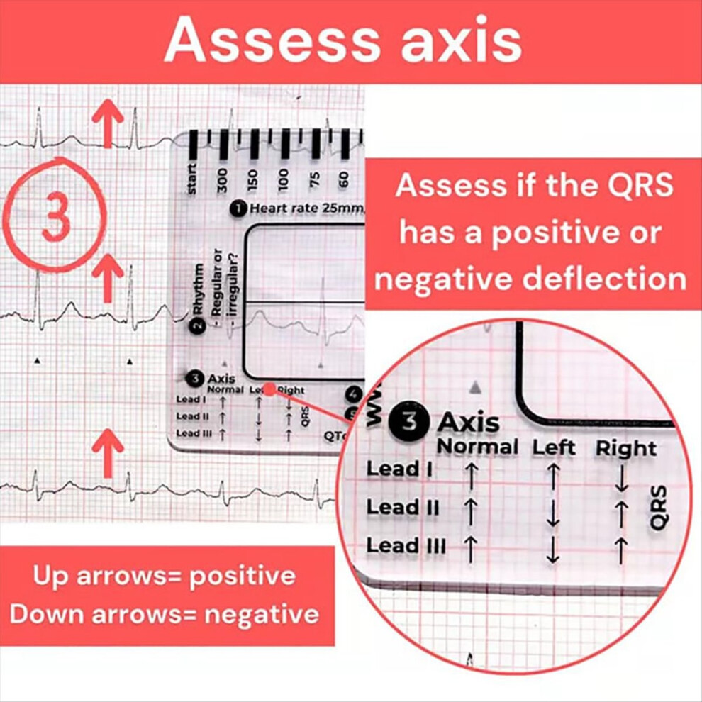 Règle ECG à 7 graduations, outil de mesure transparent pour l ...