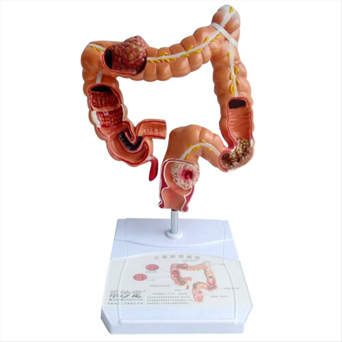 Modelo didáctico, anatomía del intestino grueso humano, lesión visceral ...