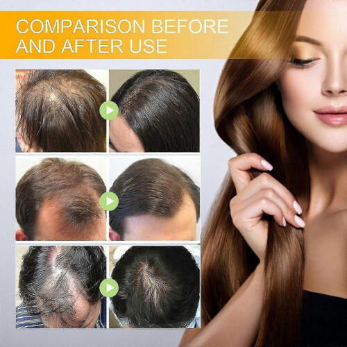 3x Biotin Hair Growth Spray Anti Hair Loss Fast Regrowth Scalp ...