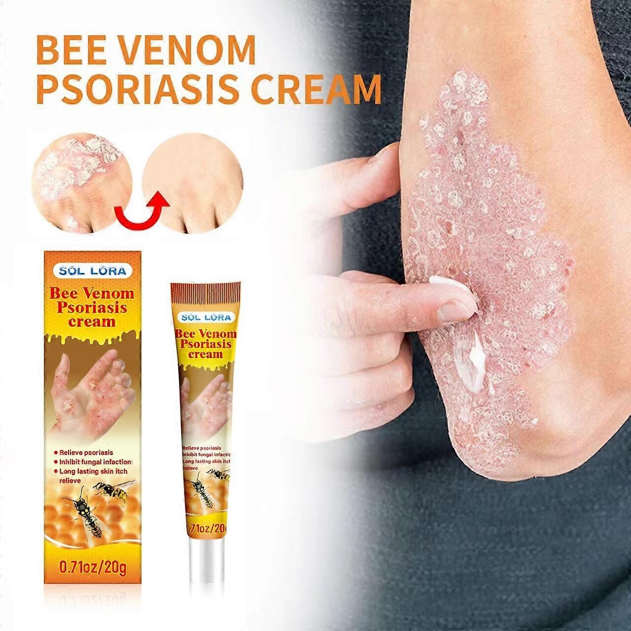 Bee Venom Skin Repair & Itch Relief Cream, Foot Care Moisturiser, Anti ...
