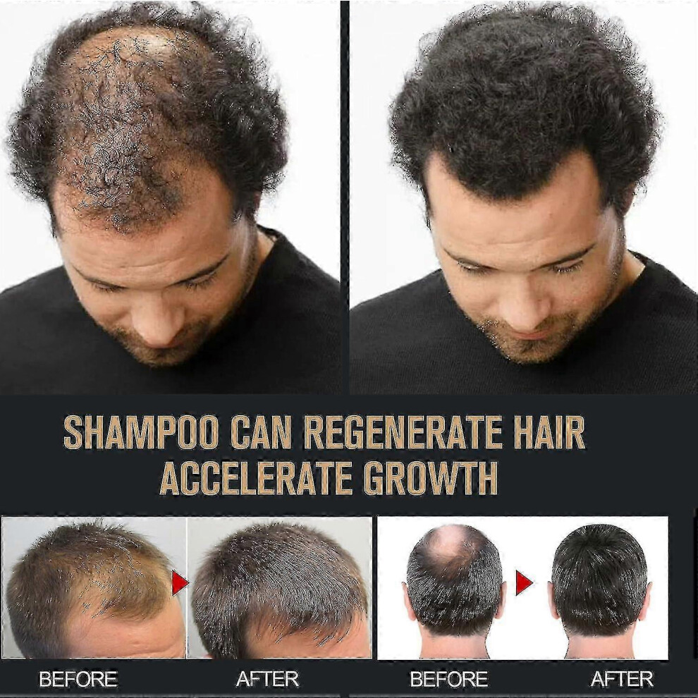 (3pcs) Root Activator Shampoo, Mane Root Activator Shampoo, Shampoo ...
