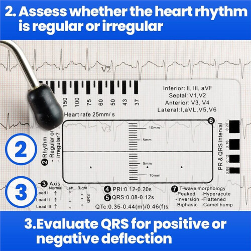 Lot de 10 Règles ECG à 7 Niveaux, Compas ECG Transparent pour une ...