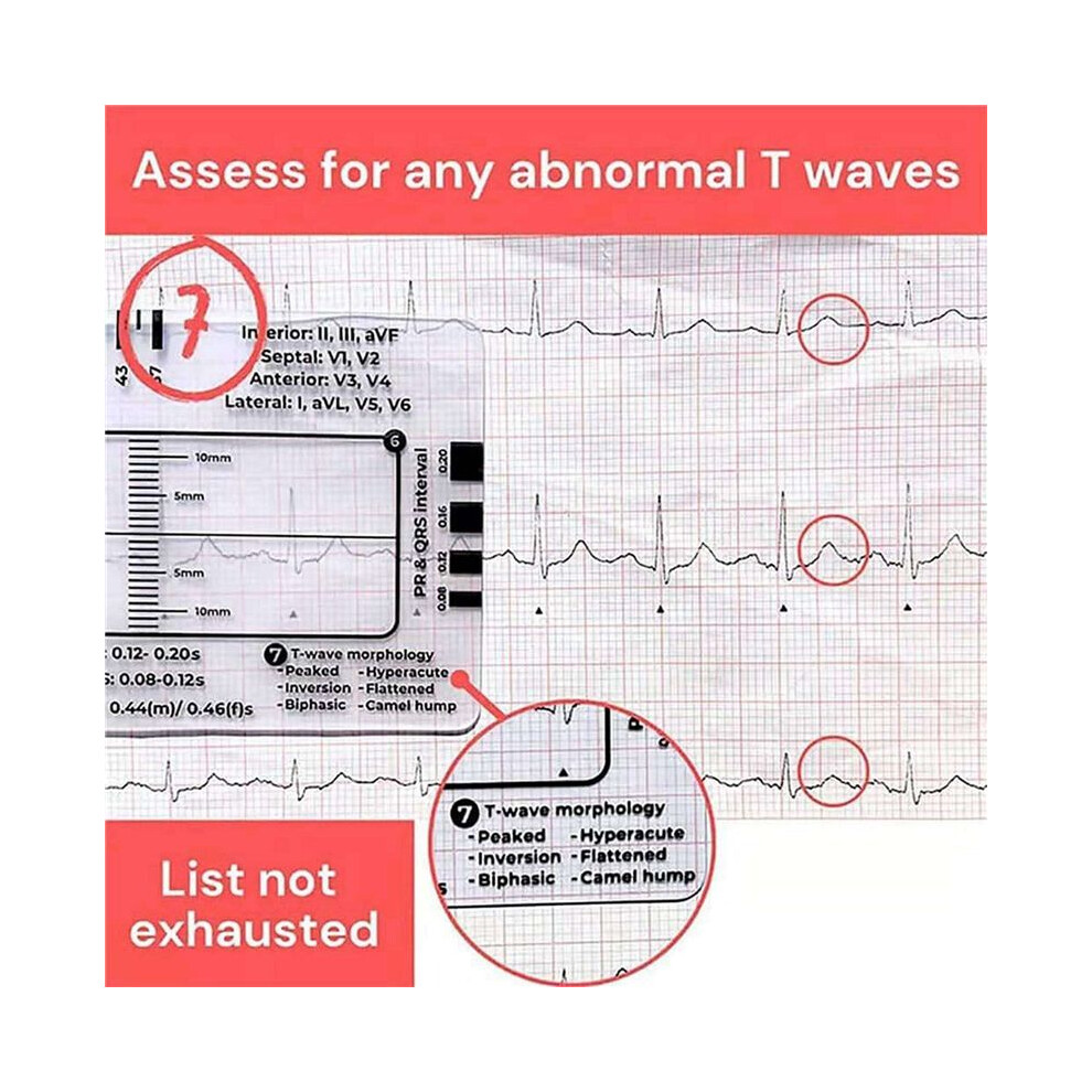 4pcs ECG 7 Step Ruler,ECG 7 Step Ruler for ECG/EKG Interpretation,ECG ...