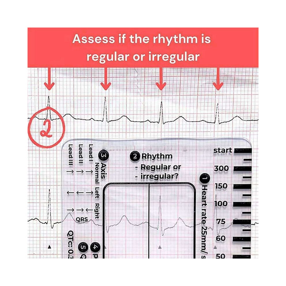 4pcs ECG 7 Step Ruler,ECG 7 Step Ruler for ECG/EKG Interpretation,ECG ...