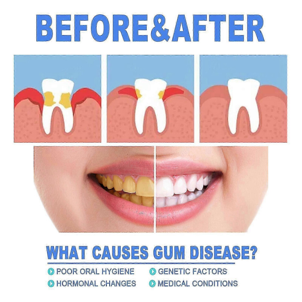 (3pcs) Gum Shield Gel - Advanced Gum Treatment & Disease Management ...