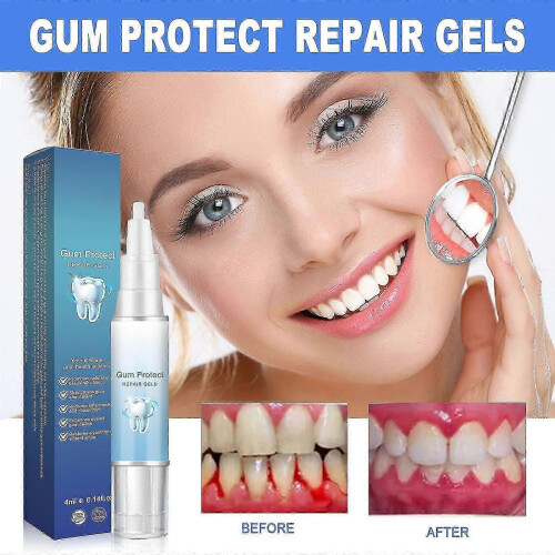 (3pcs) Gum Shield Gel - Advanced Gum Treatment & Disease Management ...