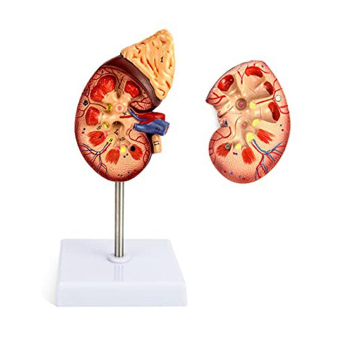 2X Life-Size Kidney Model, 2 Parts Showing Internal Structure A Kidney ...