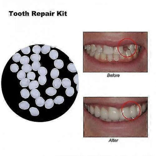 10g Denture Solid Glue Resin Teeth Restoration Adhesive Kit 10g on OnBuy