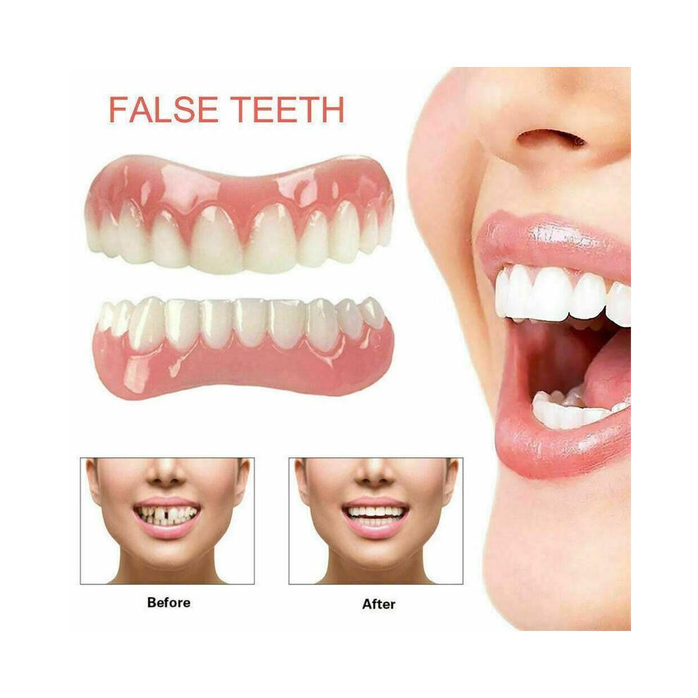 Veneers False teeth snap on instant Smile veneers Cosmetic Teeth ...