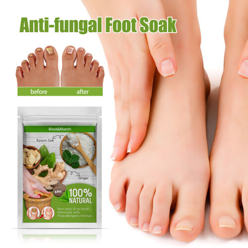 Anti-fungal Foot Soak, Foot Gray Nail Repair Bright Nail Deodorizer ...
