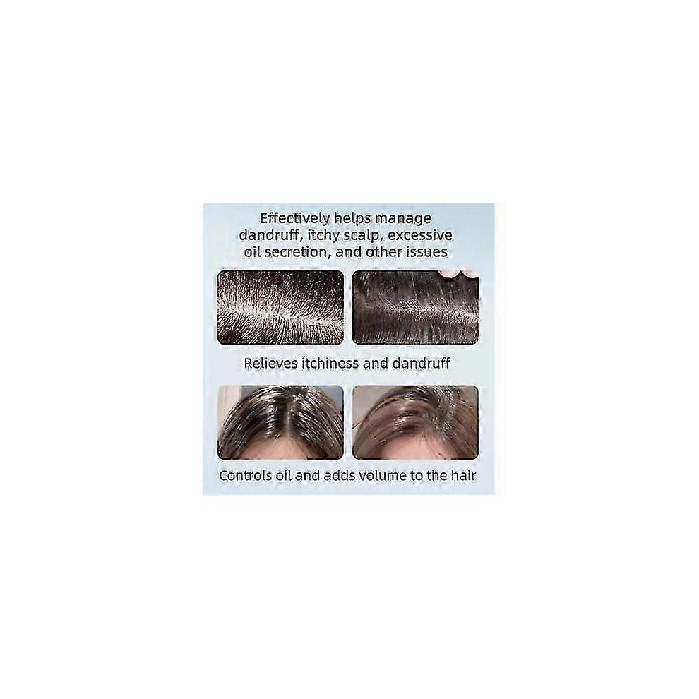 Selenium Disulfide Anti-Dandruff Shampoo Controls Oil, Reduces Flakes ...