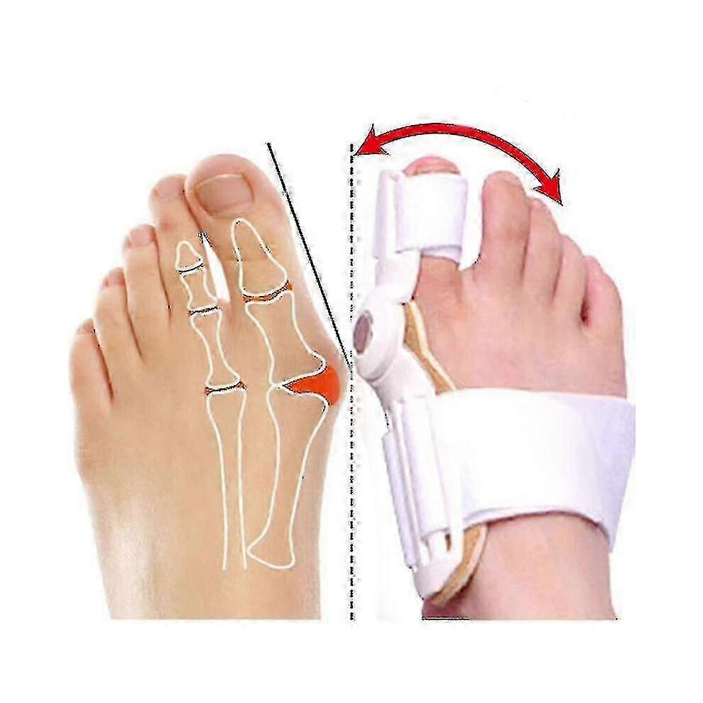 Hallux Valgus Corrector - Day And Night Strengthening for Hallux Valgus ...
